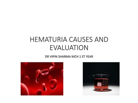 Haematuria | PPT