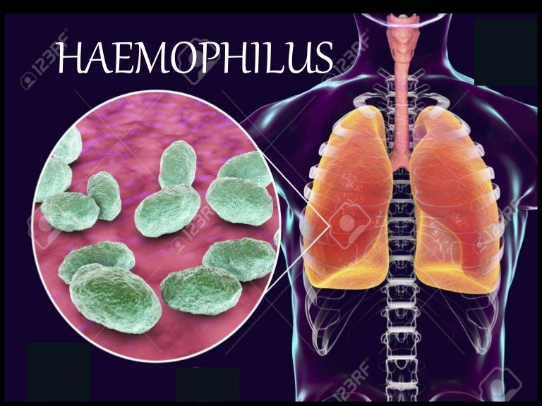 Haemophilus species