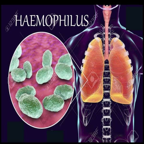 Haemophilus species | PPTX