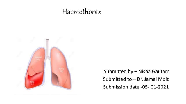 massive hemothorax | PPTX