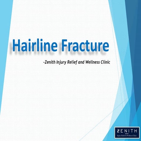 Hairline Fracture - Causes, Symptoms and Treatment.