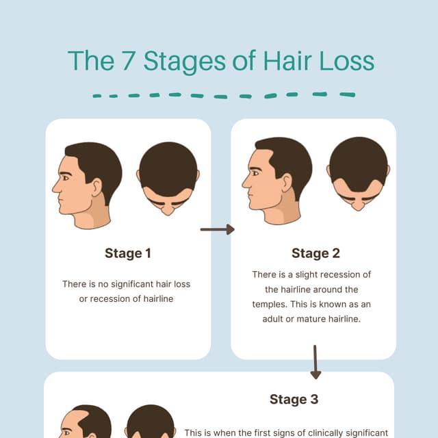 Hair loss Infographic.pdf