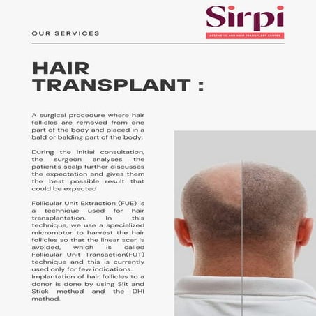 HAIR TRANSPLANT | PDF