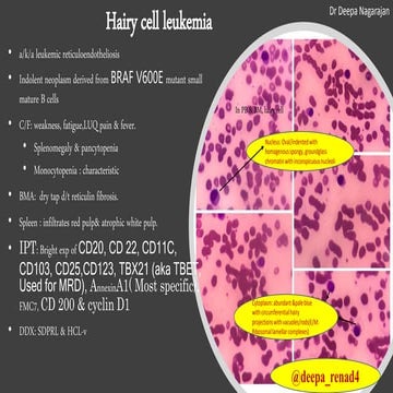 Hairy cell leukemia | PPTX