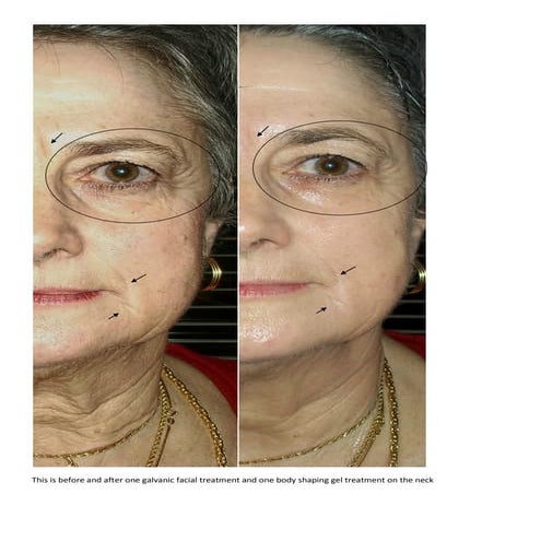 Half Face Before And After | PDF