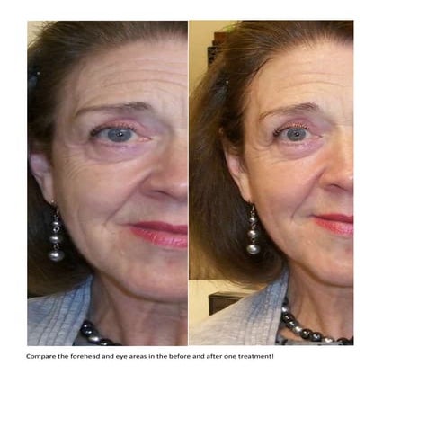 Half Face Before And After 2 | PDF