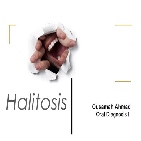 Halitosis , , Malodor , Bad breath | PPT