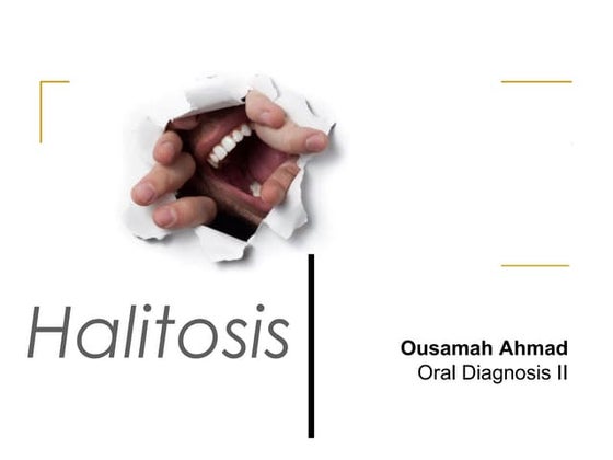 HALITOSIS | PPT