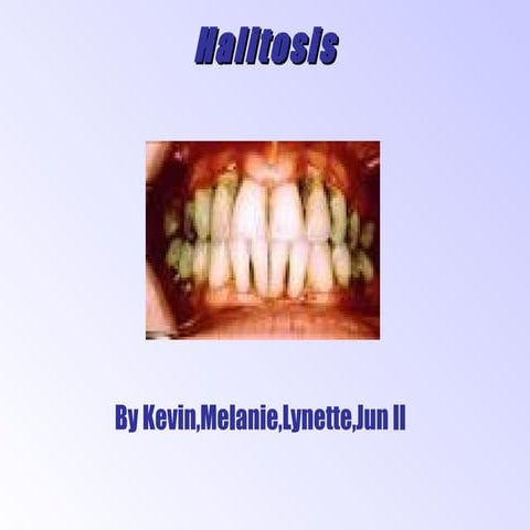 Presentation on halitosis (bad breath).. | PPTX