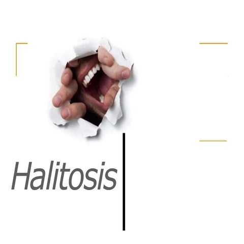 HALITOSIS.pptx