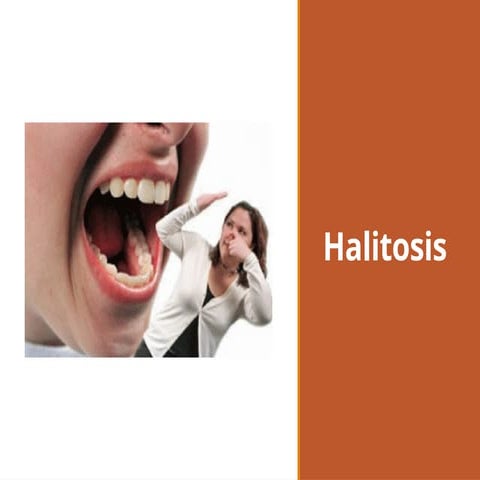 halitosis.pptx Halitosis periodontology carranza | PPTX