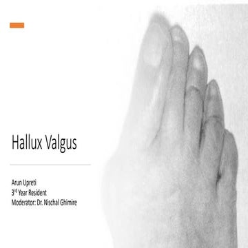 Principles of Management of Hallux Valgus | PPT
