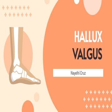 Hallux valgus exposicion con imagenes y maniobras | PDF