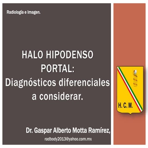 Halo hipodenso portal | PPTX