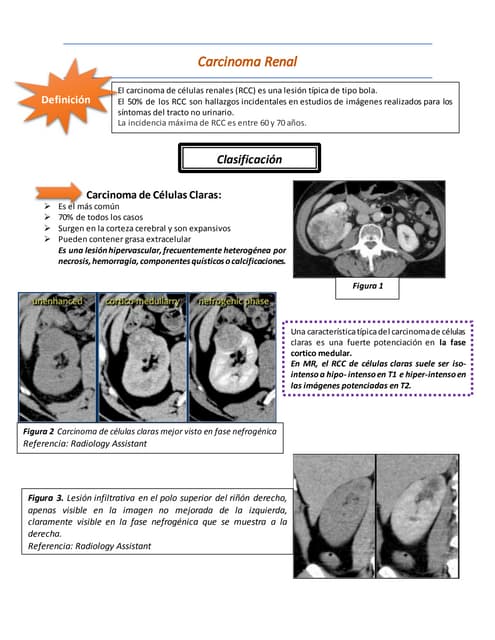 Ecografia renal | PPT