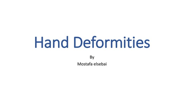 Hand deformity in rheumatoid arthritis | PPTX