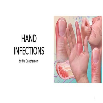 Hand Infection .pptx | Nail Care | Beauty