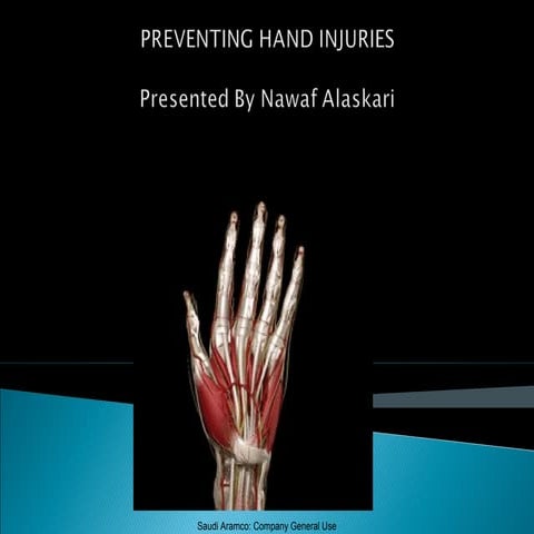 Hand injuries | PPS | First Aid | Injuries