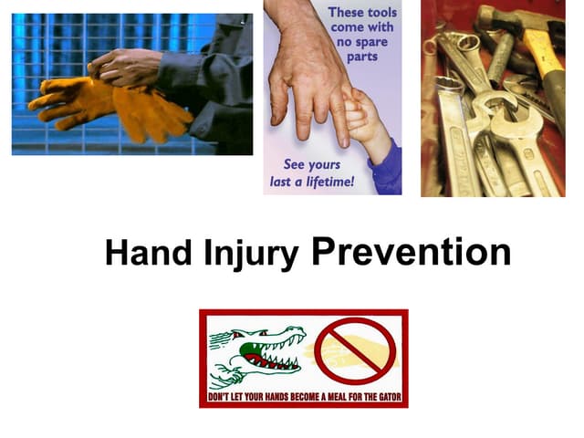 Hand Injury Prevention Campaign Watch Your Finger | PPTX