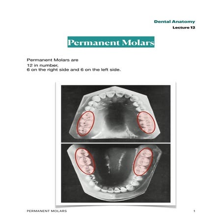 Variations of maxillary molars | PPTX