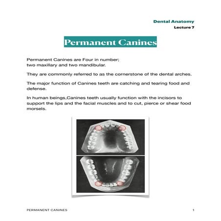 Maxillary and Mandibular Canines | PPT