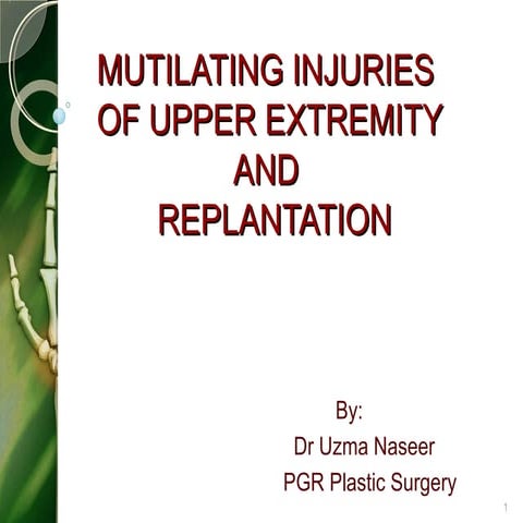 Hand replantation | PPT
