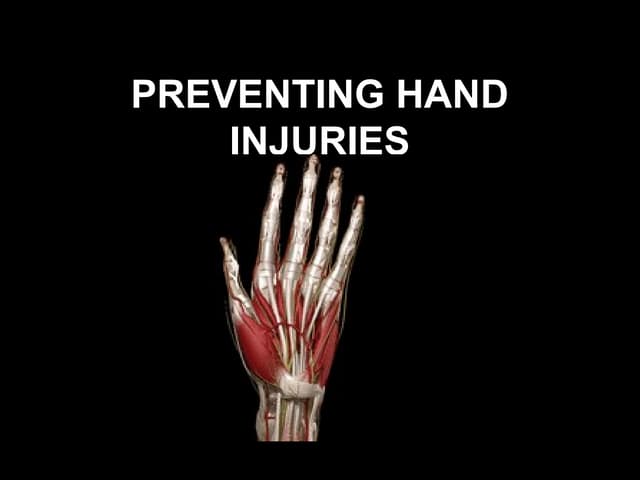 Hand Injury Prevention Campaign Watch Your Finger | PPTX