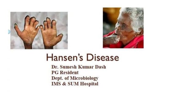 Leprosy | PPT | Infectious Diseases | Diseases and Conditions