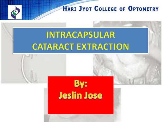 Extracapsular Cataract Extraction Docx