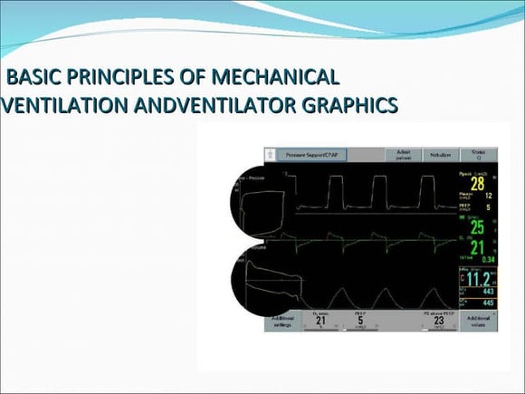 Ventilator Waveforms Ppt