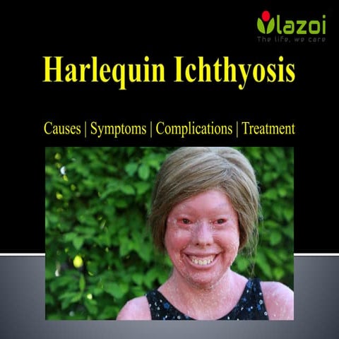 Harlequin Ichthyosis: Causes, symptoms, complications and treatment. | PPTX