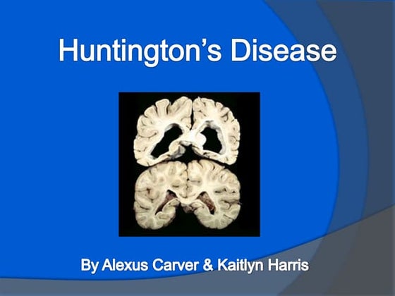 Huntington’s disease | PPT | Brain and Nervous System Disorders ...