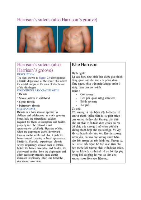 Obstetrical pelvic measurements | PPT