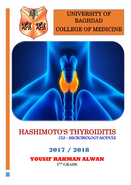 Hashimoto’s thyroiditis | PPTX