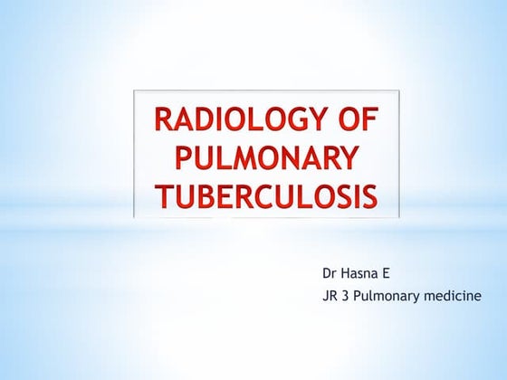X-Ray: Miliary Tuberculosis | PPT | Diseases and Conditions | Medical Health