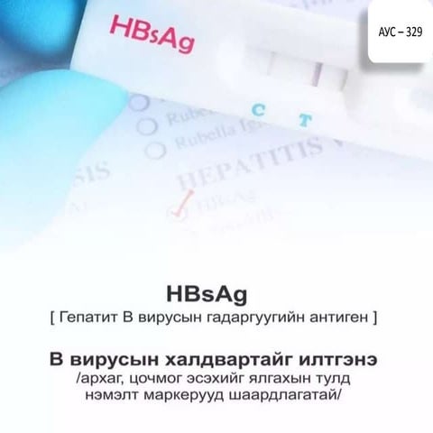 H bs ag, anti hbs | PPTX