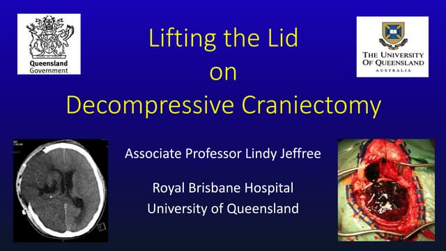 FTP Decompressive Craniotomy: How I do it? | PPTX