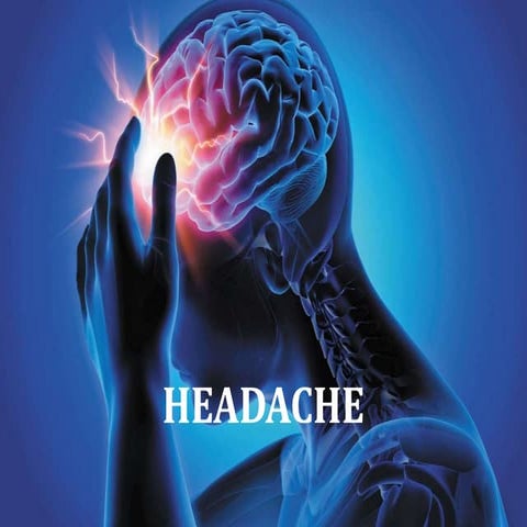 Headache | PPTX