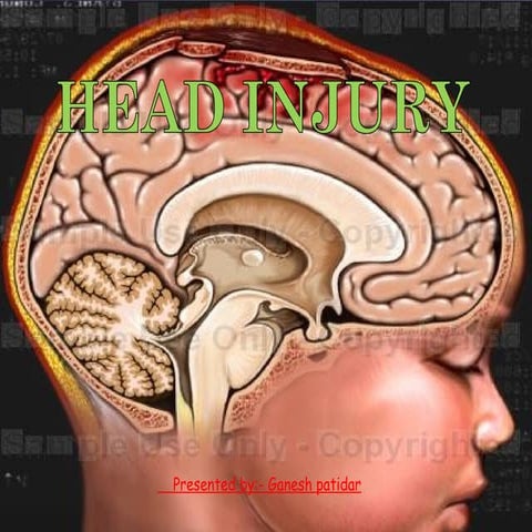 Head injury | PPT