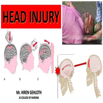 Head injury | PPTX | Death, Injury, or Military Conflict | Sensitive Topics