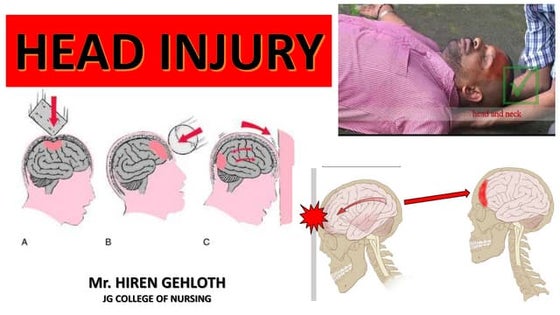 Traumatic brain injury | PDF | Death, Injury, or Military Conflict ...