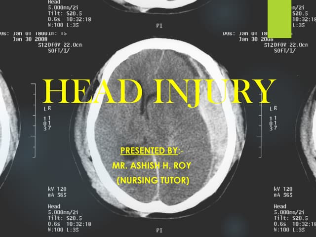 Head injury ppt | PPTX