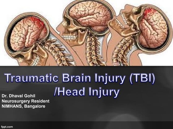 Post traumatic seizure | PPTX