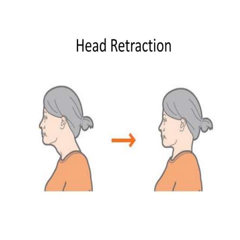 Head retraction | PPTX