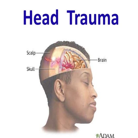 Head trauma | PPTX