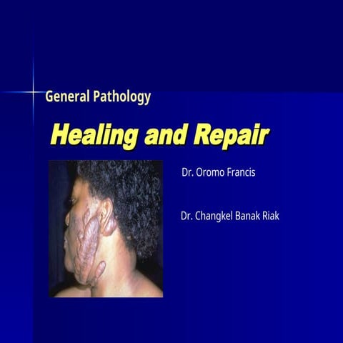 Healing_and_Repair presentation lecture.ppt