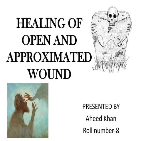 Healing of an open wound | PPTX