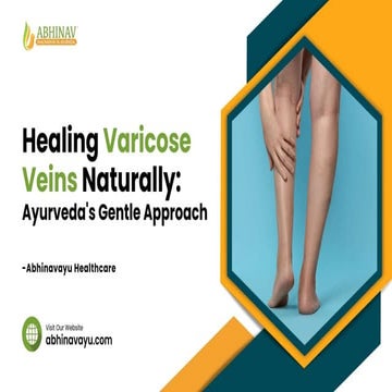 Healing Varicose Veins Naturally - Ayurveda's Gentle Approach.pptx