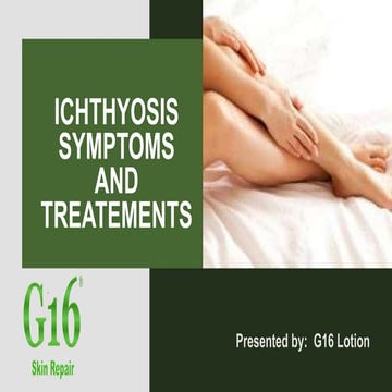 Ichthyosis Symptoms and Treatments - G16 Lotion