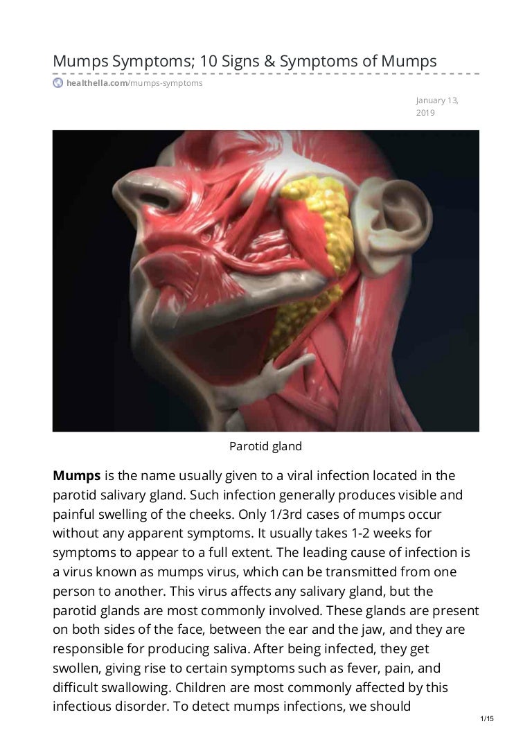Mumps symptoms; 10 signs and symptoms of mumps. Healthella.com